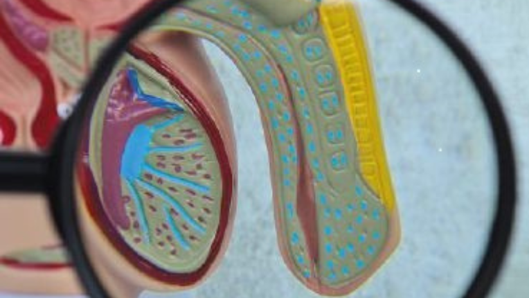 Le cancer de la verge souvent lié au papillomavirus | Elsan